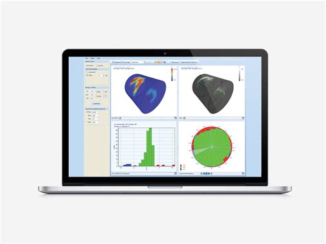 Arccheck® Sun Nuclear