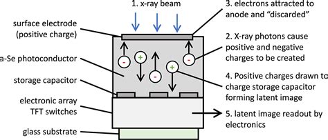 Digital Radiography Technique Chart Ponasa