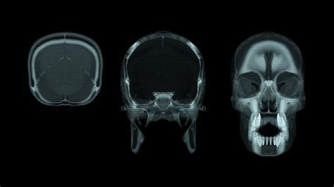 Blender Ct Scan Xray Shader