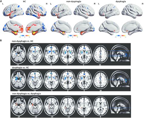 A The Functional Connectivity Pattern Of The Affective Network An Download Scientific