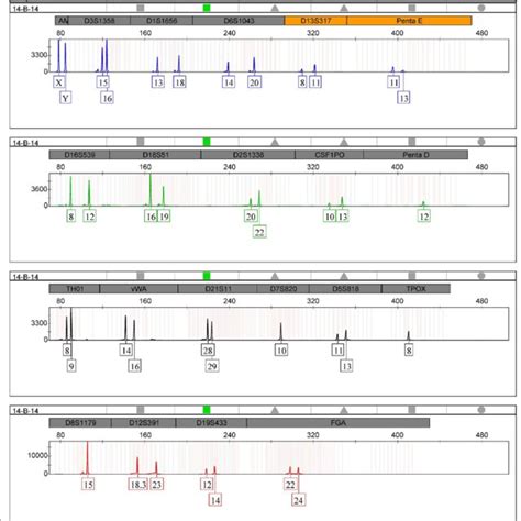 Electropherogram Of Tooth Sample Showing Amplification At All 21 Loci