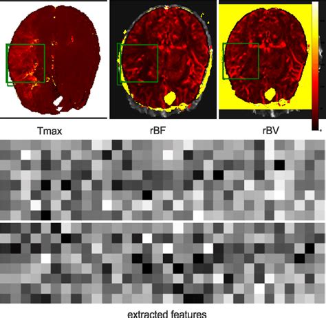 Sample Of Extracted Features Using Denoising Auto Encoder Green Boxes