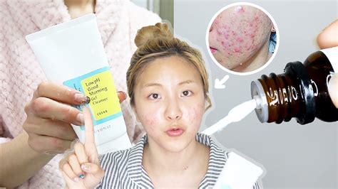 재구매만 몇통 1만원대 여드름 인생템 소개해요 Feat여드름 추천템 Youtube