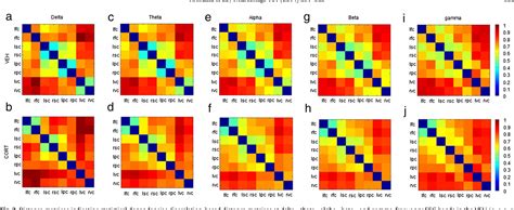 Figure 2 From Tracing The Evolution Of Multi Scale Functional Networks In A Mouse Model Of