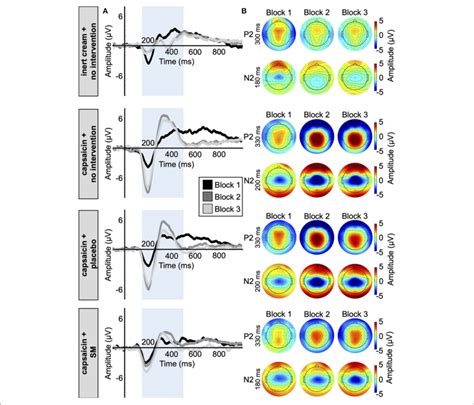 Aδ Fiber Laser Evoked Potentials A Average Waveforms For The N2