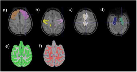 Diffusion Data Regions Of Interest Depiction Of Regions Of Interest Download Scientific