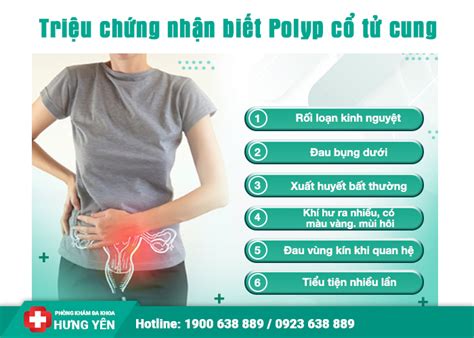 Tìm hiểu Polyp cổ tử cung là bệnh gì cách khắc phục hiệu quả Phòng Khám An Bình