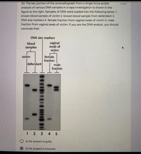 Solved 1 Point 20 The Key Portion Of The Autoradiograph