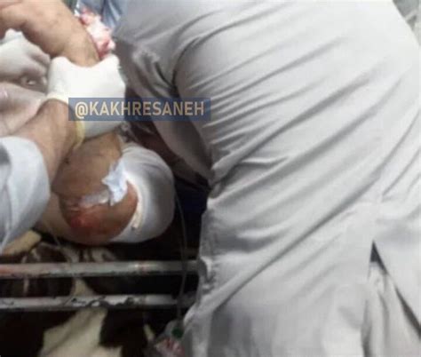 خبرآنلاین تصاویر عکس‌های تازه از هانی کُرده روی تخت بیمارستان و محل اصابت تیر
