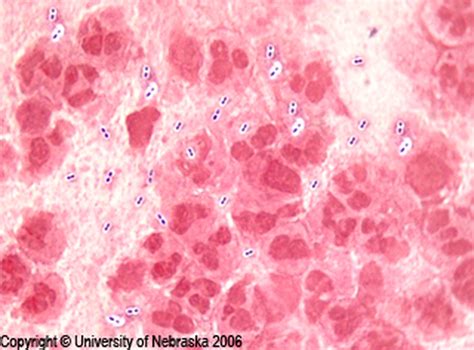 What Does White Blood Cells In Gram Stain Mean Detroit Chinatown