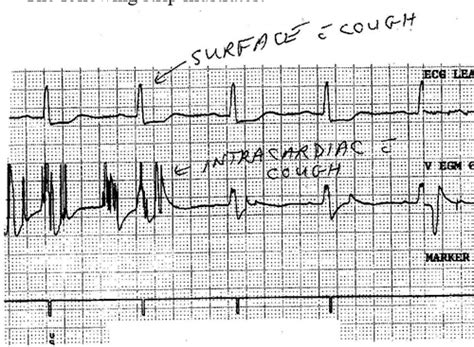 icd quiz flashcards quizlet