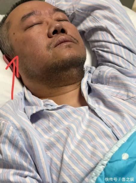突发！涂磊生病住院，本人晒照很憔悴，满脸胡渣状态看着很差 360娱乐，你开心就好