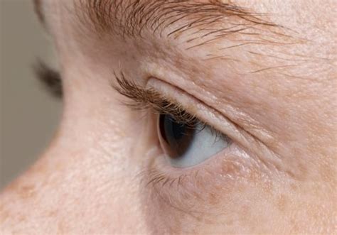 Retinopati Diabetes Penyebab Gejala Dan Penanganannya