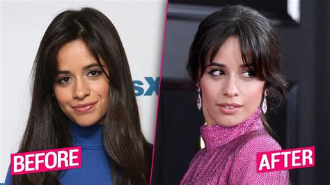 Camila Cabellos Alleged Plastic Surgery Transformation Exposed