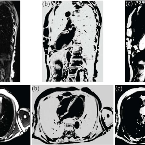 Solubility Of Sio 2 Vs Ph Calculated From Thermodynamic Values Given Download Scientific