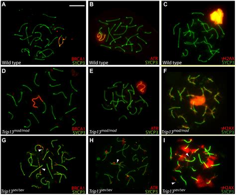 Sex Body Formation In Trip Mutant Mice Spread Chromosomes Of Download Scientific Diagram