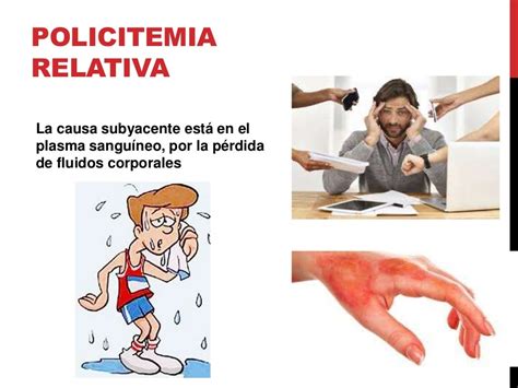 Eritrocitosis