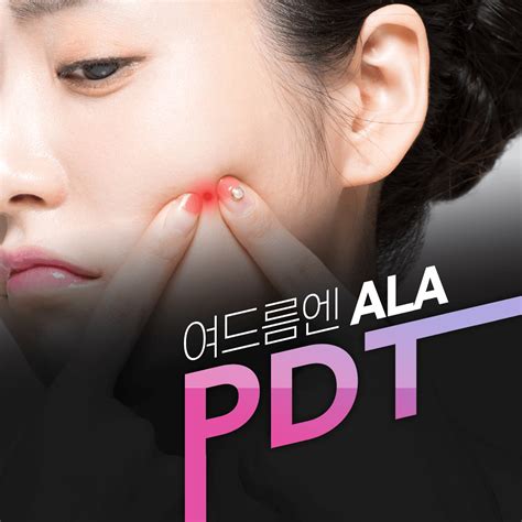 Pdt 여드름 레이저 할인 가격 후기 전후 효과 정보 By 튠의원압구정점 여신티켓 국내 1등 피부과 성형외과 플랫폼