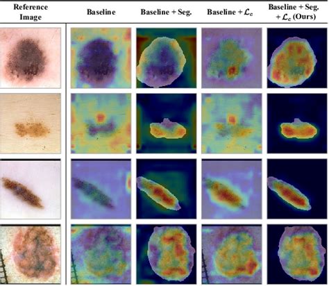 Effect Of Segmentation Examples Of Generated Feature Maps By The Download Scientific Diagram