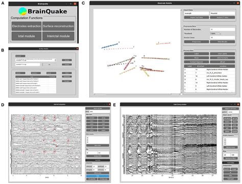 The Graphical User Interfaces Guis Of The Main Window Of Brainquake