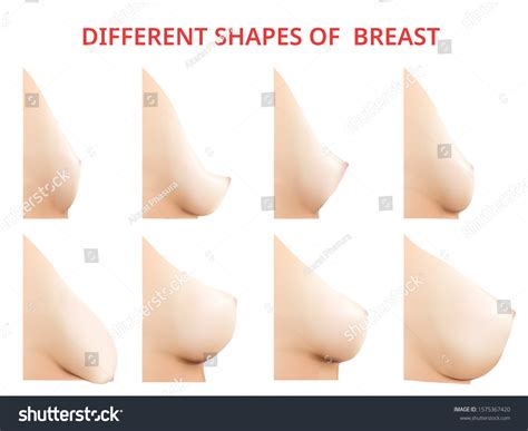 Different Breast Shapes Real Examples