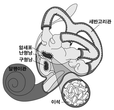 이석증 양산 새몸처럼한의원양산 새몸처럼한의원