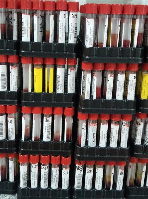 Jakir Hosen On Linkedin Pathological Specimens Potential Biohazards⚠