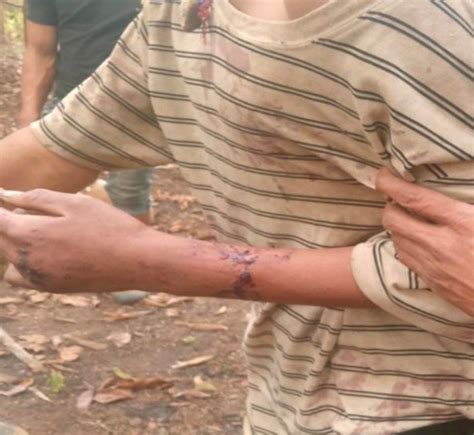 Tnla ကျန်နေတဲ့ လက်နက်ကြီး ပေါက်ကွဲမှုဖြစ်ပွားပြီး ၁ ဦး သေဆုံး၊ ၁ ဦး ထိခိုက်ဒဏ်ရာရ Positive