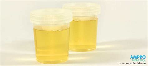 การตรวจปัสสาวะ Urinalysis Am Pro Health