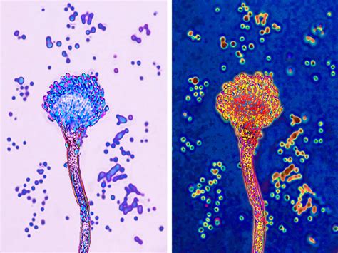 Who Releases List Of Threatening Fungi The Most Dangerous Might