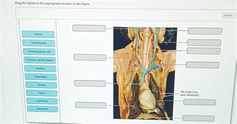 Solved Drag The Labels To The Appropriate Location In The Chegg Com