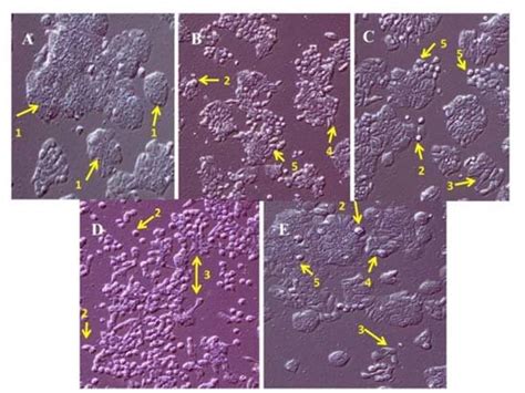 Morphology Of Ht 29 Cell Line By Phase Contrast Microscopy At ×10 A