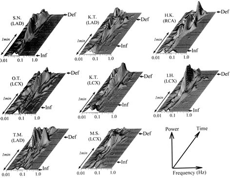 Three Dimensional Continuous Plots Wavelet Transforms Of Rr Interval