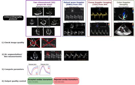 Ai Enabled Assessment Of Cardiac Function From Echocardiography Epsrc