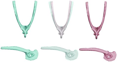 Differences In Morphology Of The Pelvic Girdle Between Cane Toads From