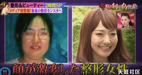 日本女狂人花1000万整容30次 面目全非图 搜狐新闻