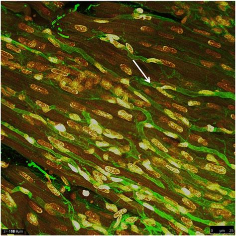 Brightest Point Projection Method To Demonstrate The 3 Dimensional Download Scientific Diagram