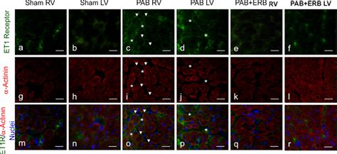 Immunofluoresence Staining Showing The Immunolabeling Of Et 1 Receptor Download Scientific