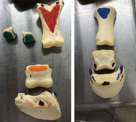 Phalanges Diagram Quizlet