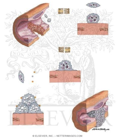 Platelet Adhesion Release And Aggregation