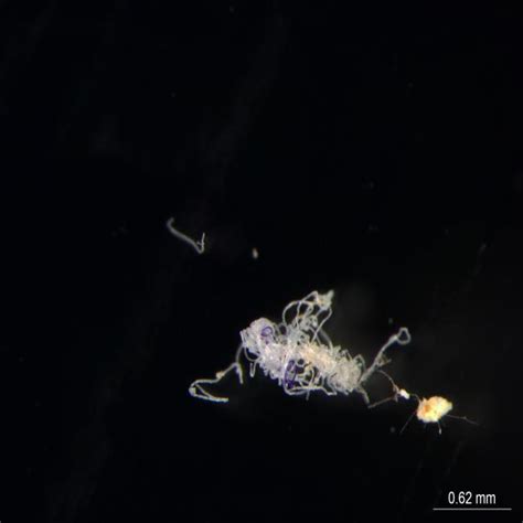 Microplastic Detection Object Detection Model By Luis Angelo Valerio