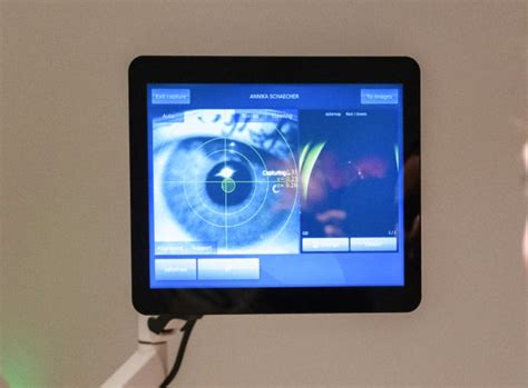 Oct And Optomap Advanced Eyecare Associates