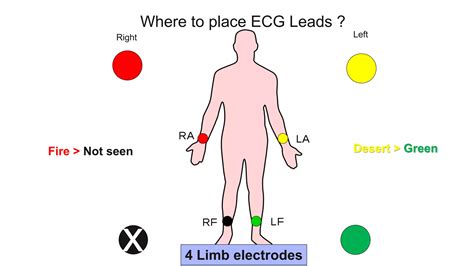 Ecg Made Easy Pdf