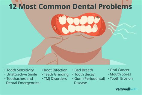 12 Common Teeth Problems