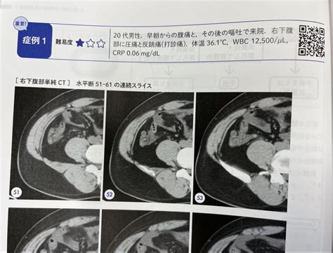 画像診断なら医学書院 on Twitter 連続スライスで学ぶ レジデントのための急性腹症のCTの見本が編集部に届きました 緊急の