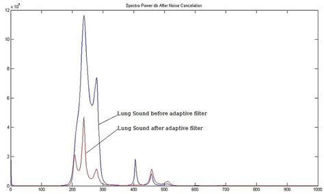 Psd Of Lung Sound Before And After Applying Anc Nlms Abnormal Subject