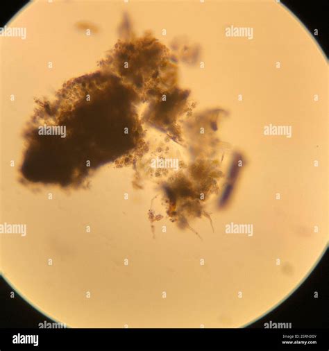 Cyanobacteria Cyanobacteria Florida Us Tiny Green Dots That Look Like Free Floating