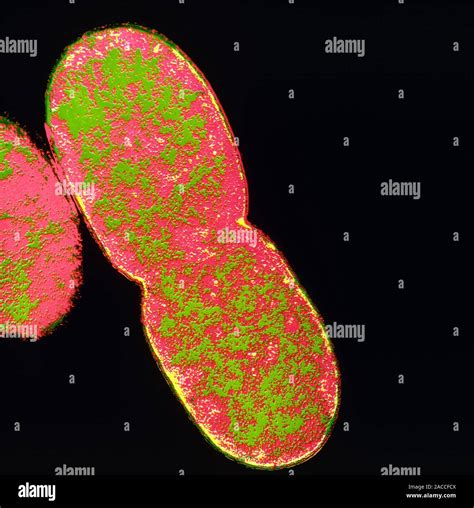 False Colour Transmission Electron Micrograph Of The Bacterium Escherichia Coli A Normal