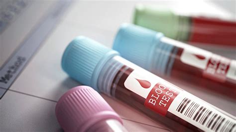 Why The A C Test May Miss Diabetes In Some African Americans Everyday Health