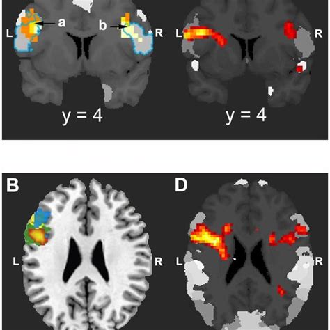 Representational Similarity Analysis Of Activations To Number And